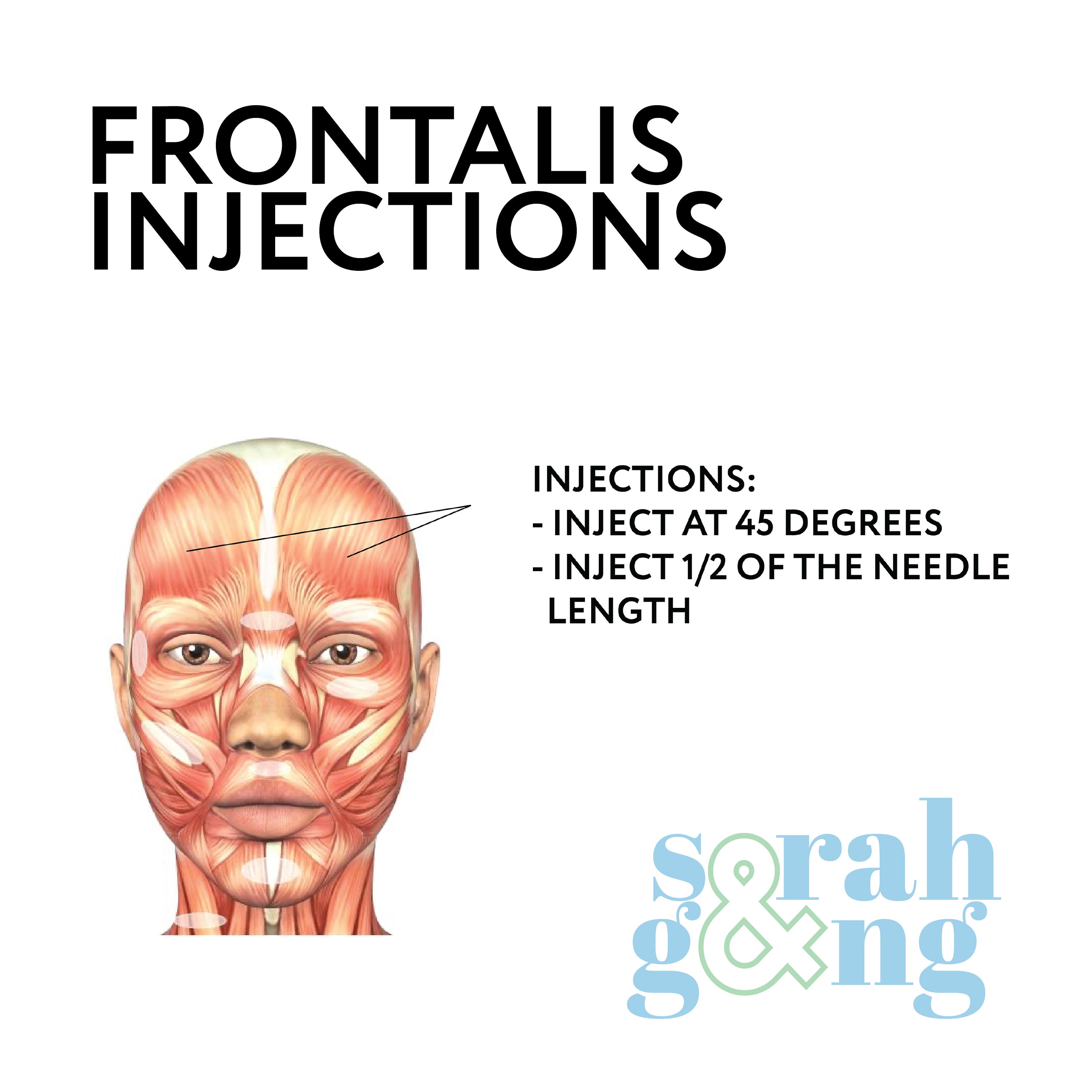 Botox Training Guide Botulinum Toxins Guide Aesthetics - Etsy