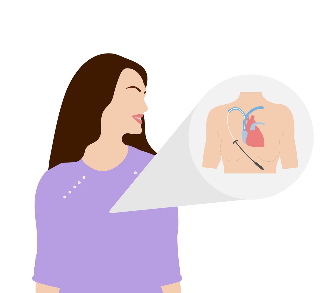 Chemo Long Sleeve Shirt With Chest Port Access in Color Sage ...