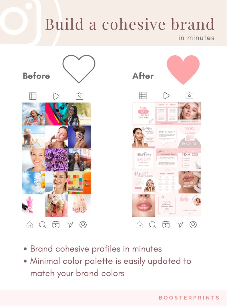 Botox Filler Instagram Template Botox and Fillers Posts Stories IG ...