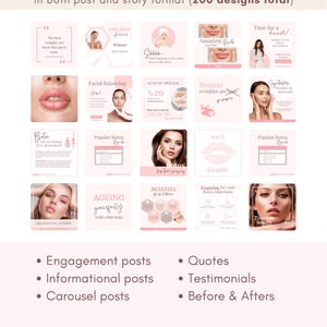 Botox Filler Instagram Template Botox and Fillers Posts Stories IG ...