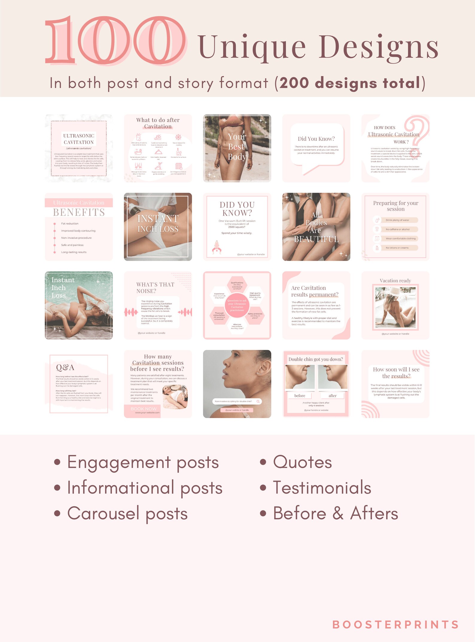 Cavitation Instagram Posts Stories IG Template Body Contouring ...