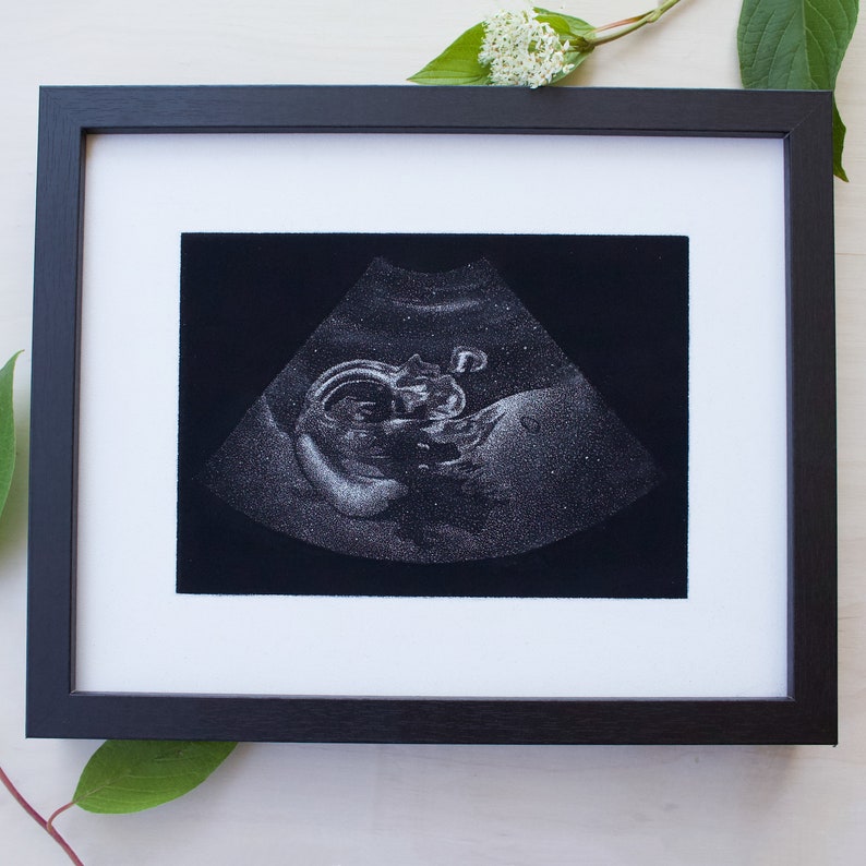 Custom Ultrasound Art or Sonogram Art | Pregnancy Keepsake, Heirloom ...