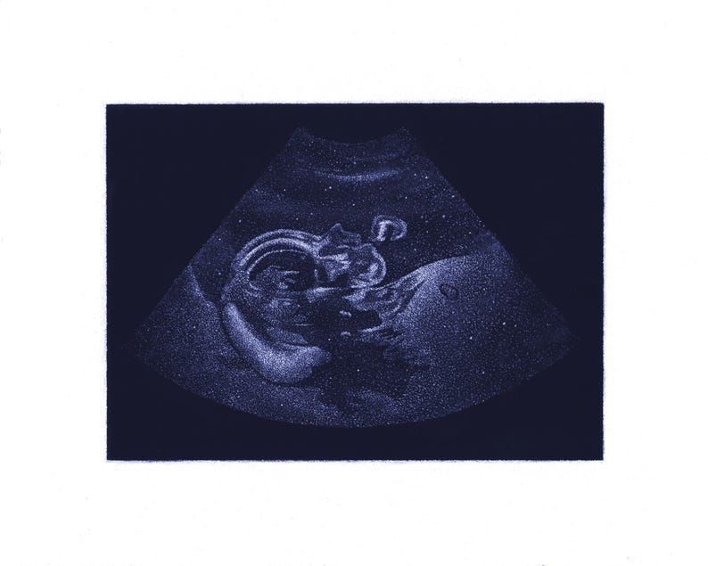 Custom Ultrasound Art or Sonogram Art | Pregnancy Keepsake, Heirloom ...