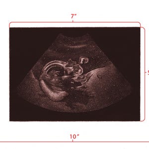 Custom Ultrasound Art or Sonogram Art | Pregnancy Keepsake, Heirloom ...