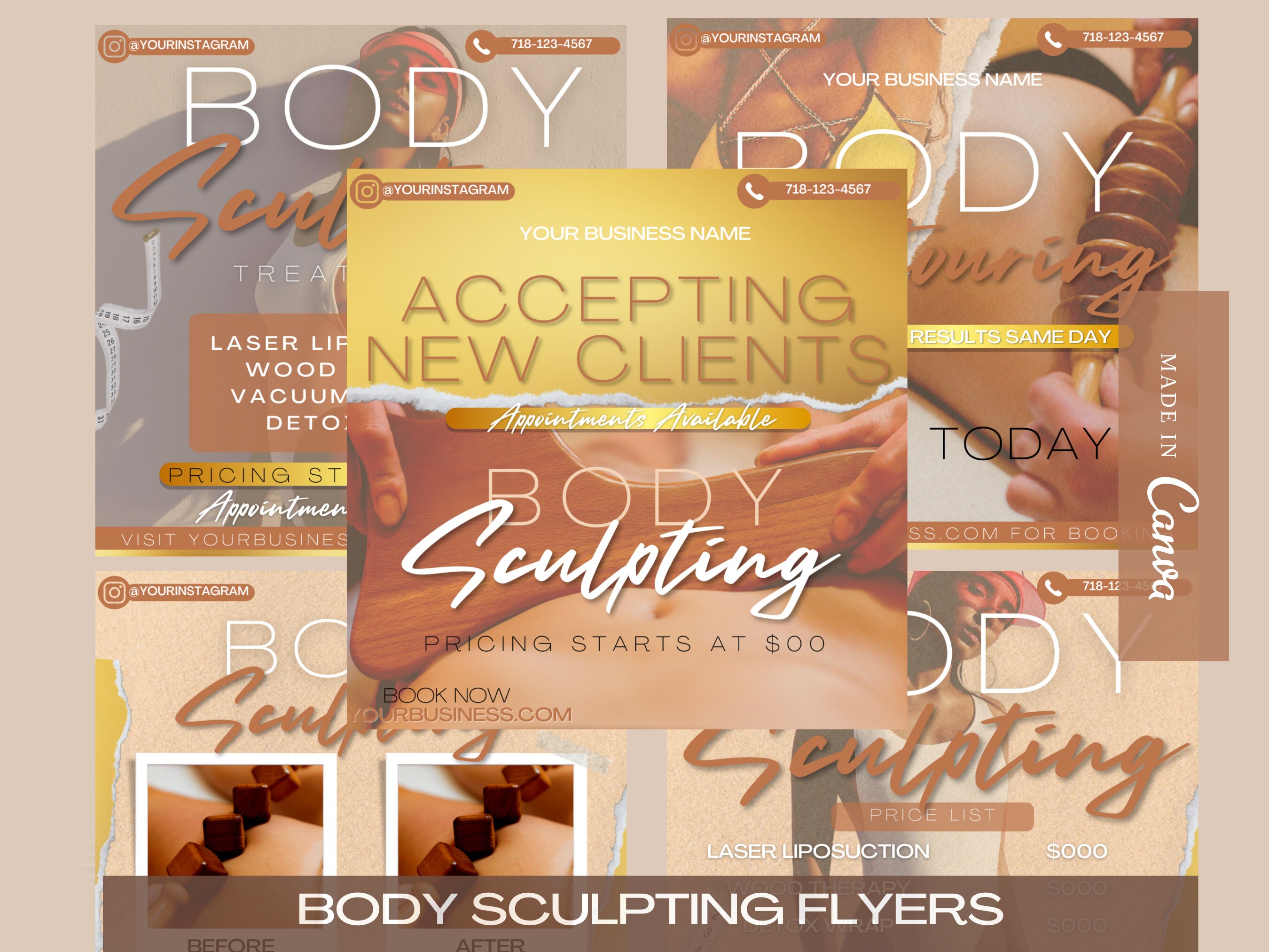 DIY Body Sculpting Templates, Body Contouring Posts, Body Contour ...