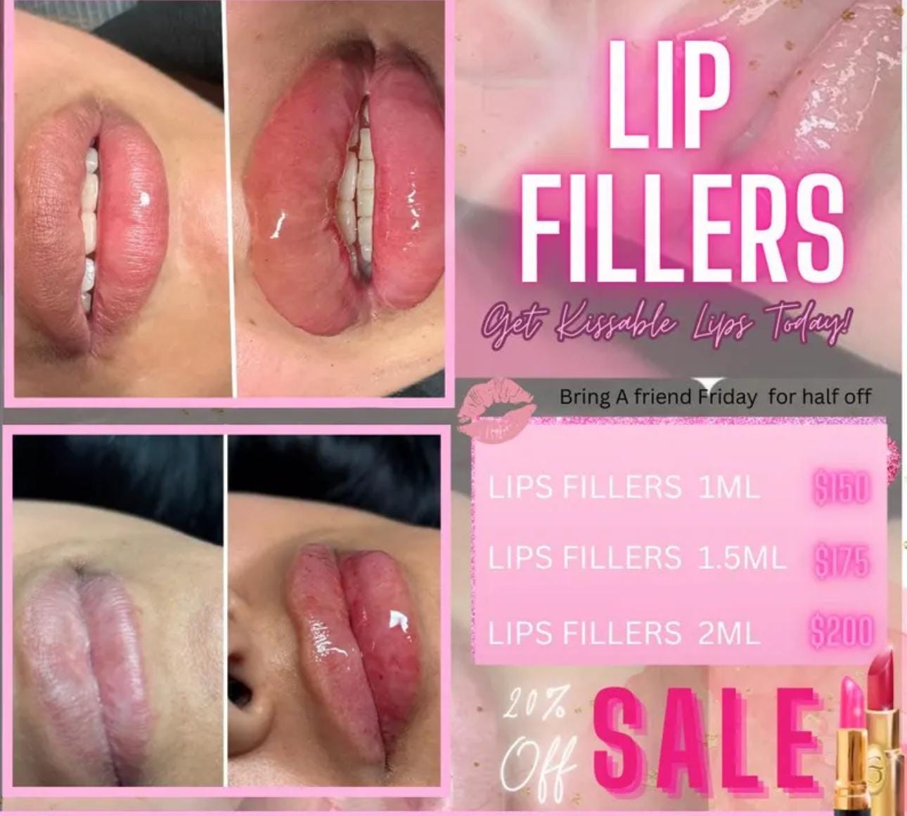 DIY LIP Filler Flyer Template, - Etsy