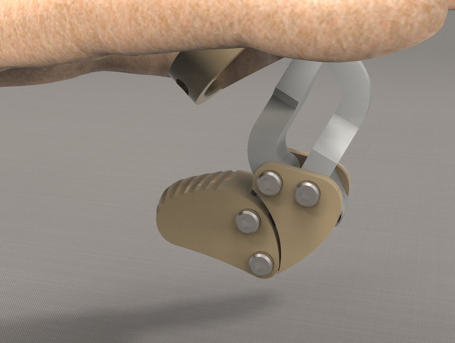 3D Print Prosthetic Finger STL Files: Full Hand Reconstruction (digital ...