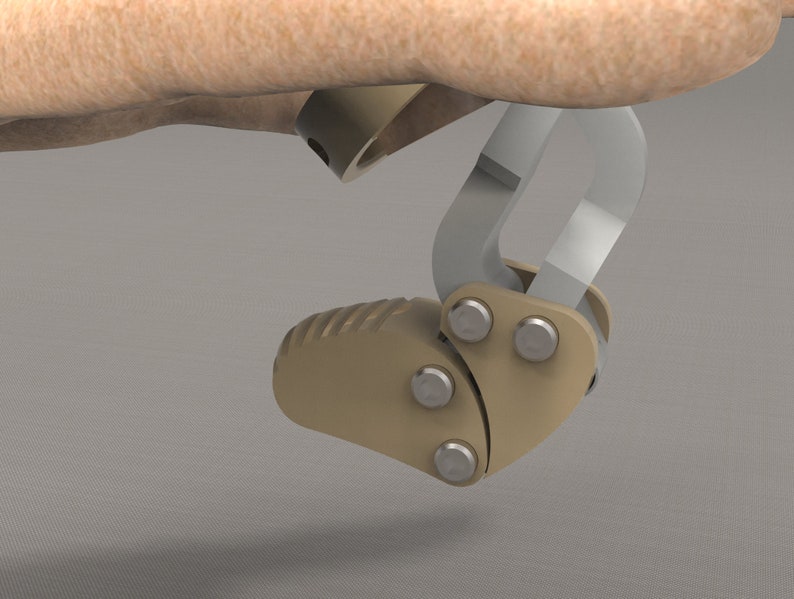 Complete Prosthetic Hand: Individual STL Files for Thumb, Index, Middle ...