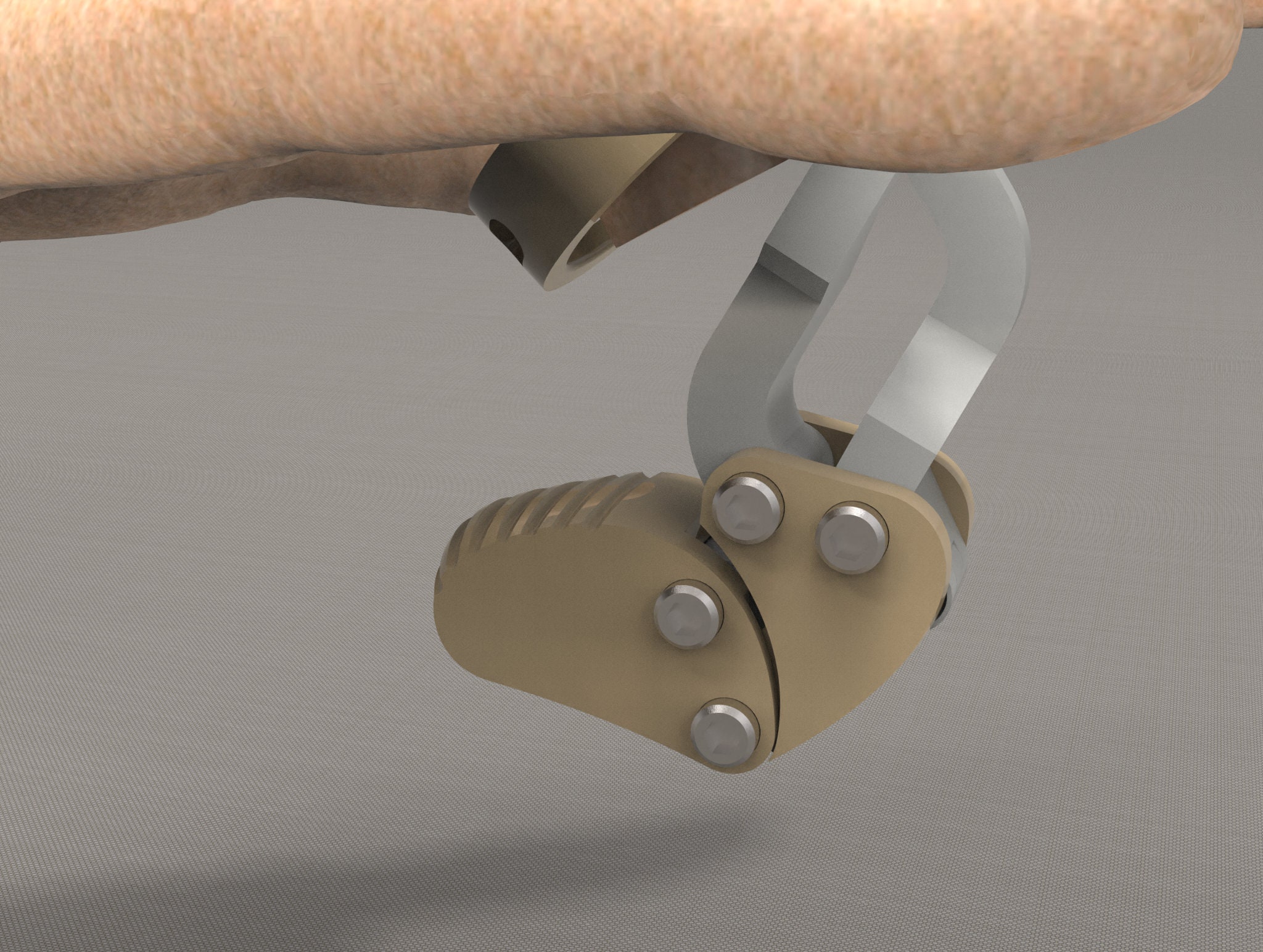 3D Print Prosthetic Finger STL Files: Full Hand Reconstruction (digital ...