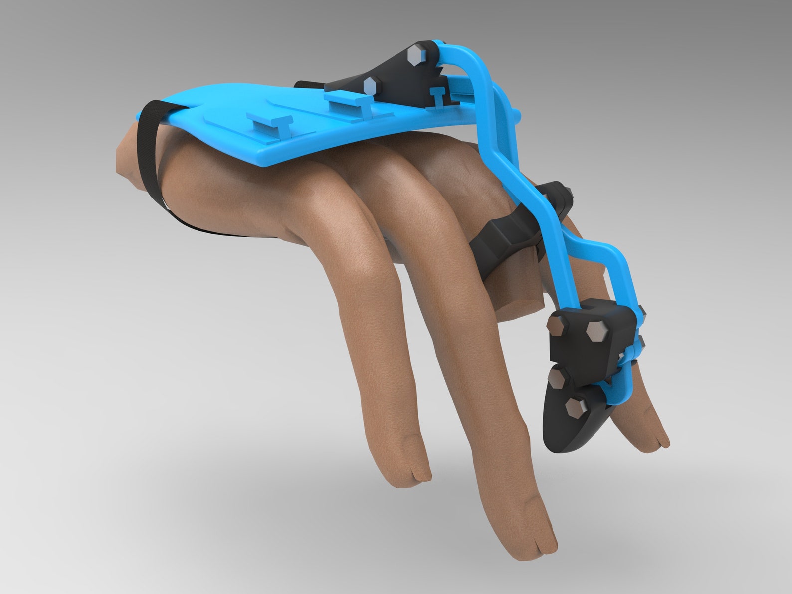 Prosthetic Fingers - 3D PRINT PROSTHETIC FINGER, Stl File Diy, Print ...