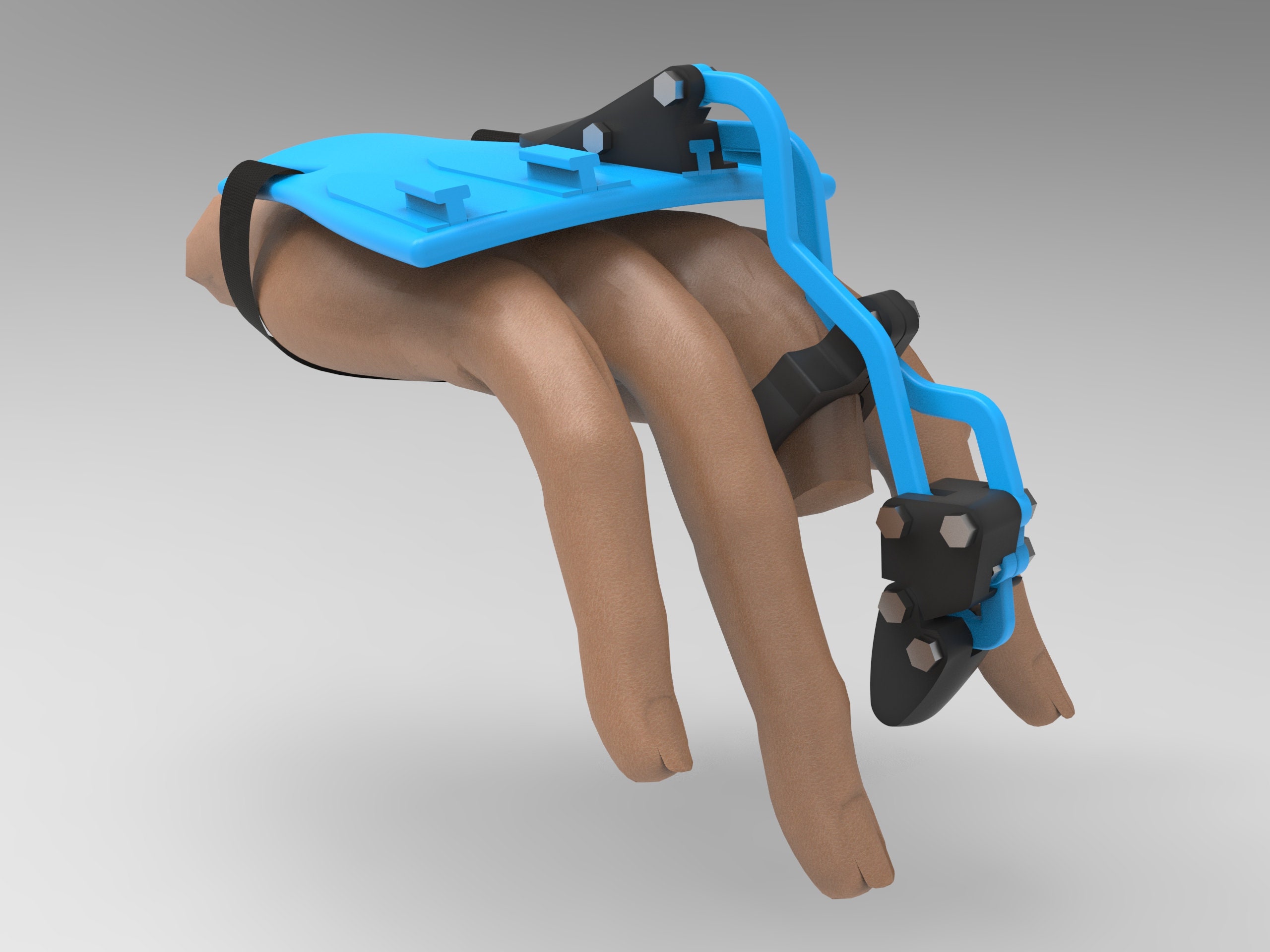 Prosthetic Fingers - 3D PRINT PROSTHETIC FINGER, Stl File Diy, Print ...