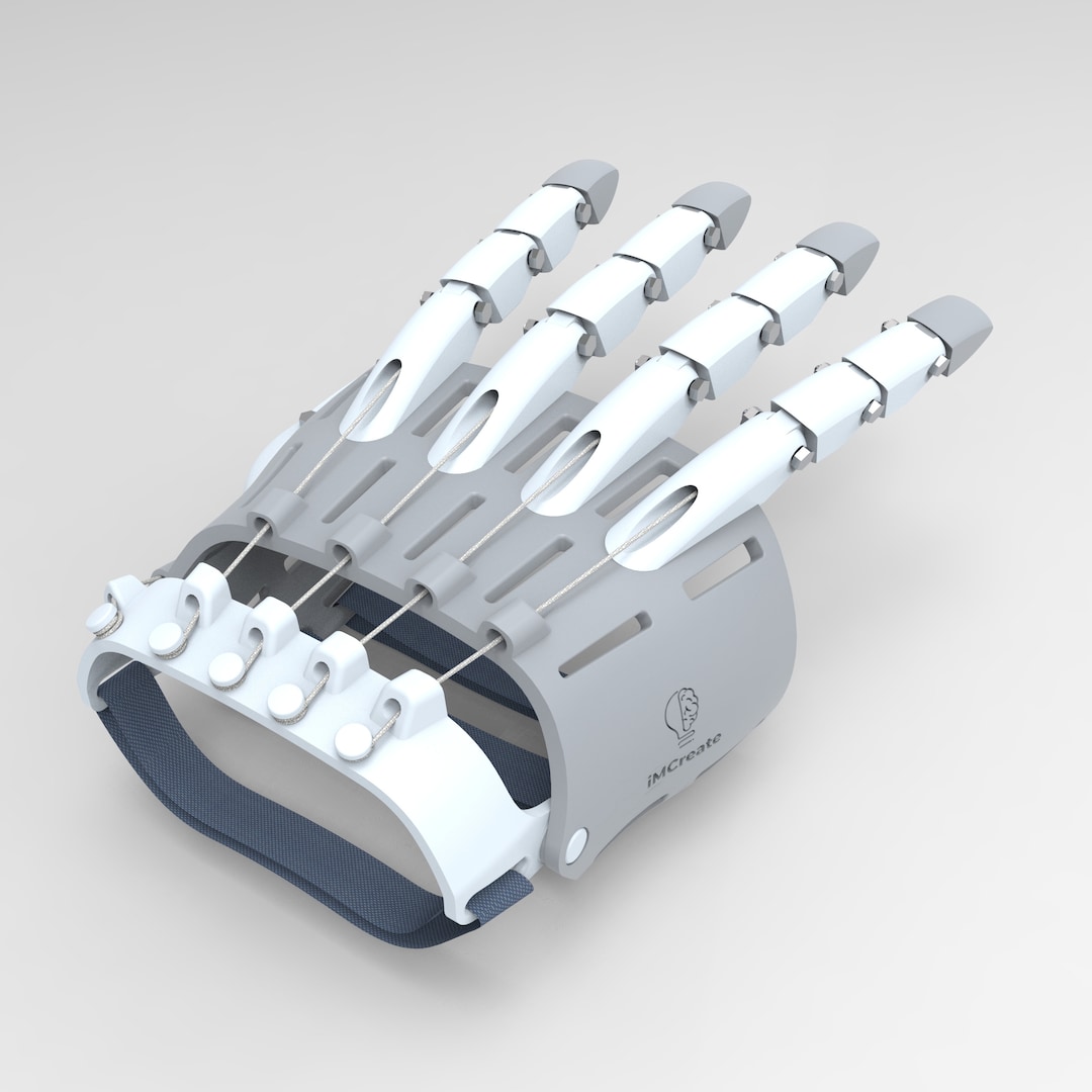 3D Print Prosthetic Hand With Elastics: STL Files (digital Download) - Etsy