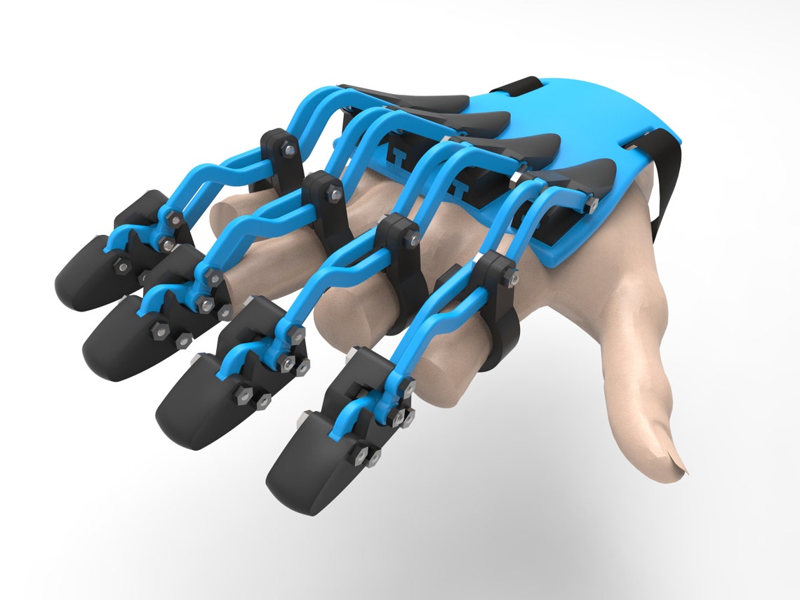 Prosthetic Fingers - 3D PRINT PROSTHETIC FINGER, Stl File Diy, Print ...