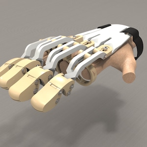 3D Print Prosthetic Finger STL Files: Full Hand Reconstruction (digital ...