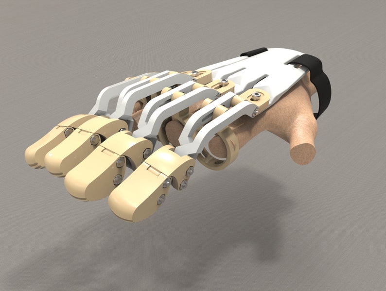 3D Print Prosthetic Finger STL Files: Full Hand Reconstruction (digital ...