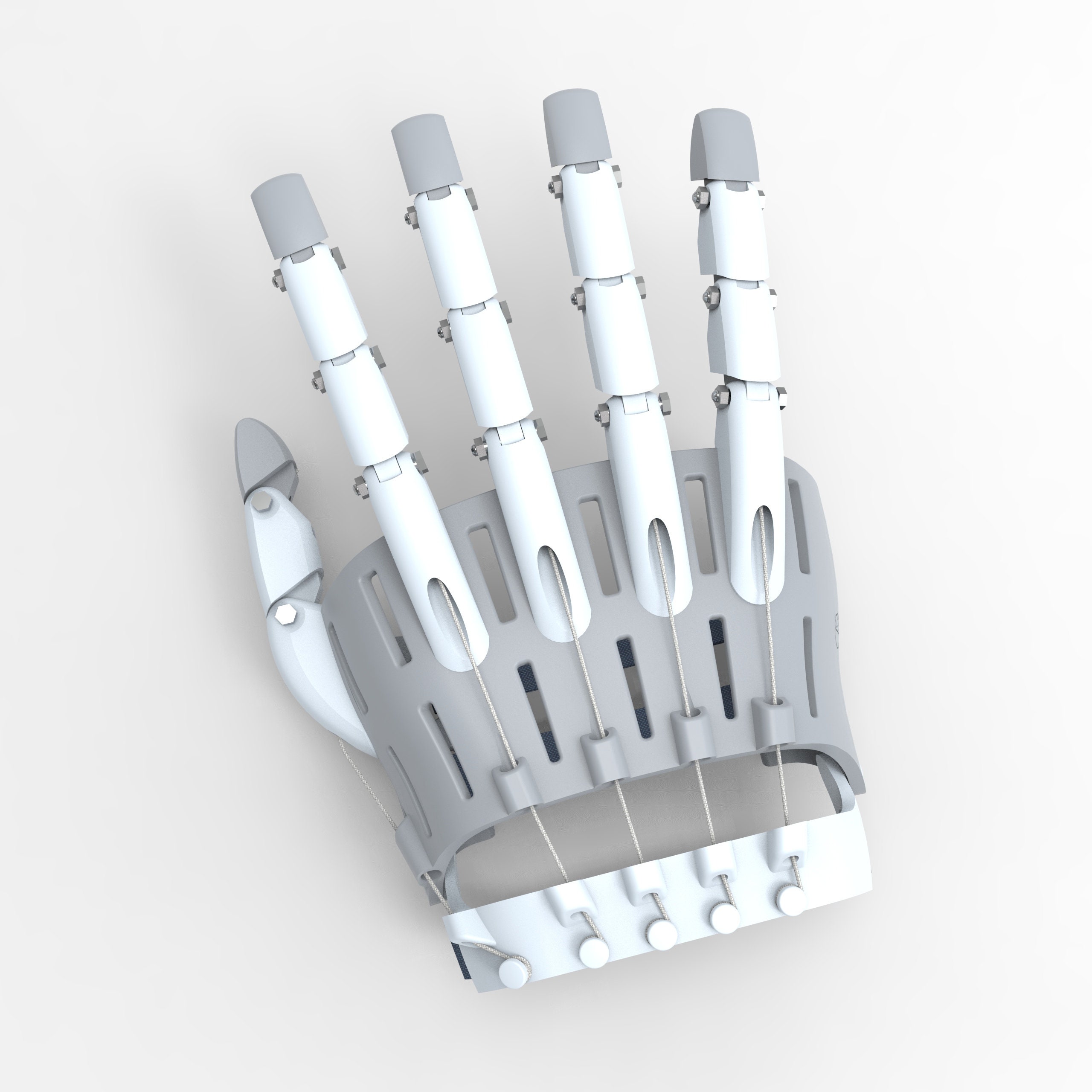 3D Print Prosthetic Hand With Elastics: STL Files (digital Download) - Etsy