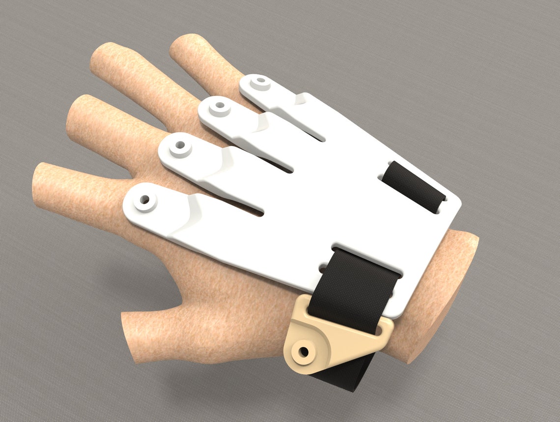 Complete Prosthetic Hand: Individual STL Files for Thumb, Index, Middle ...