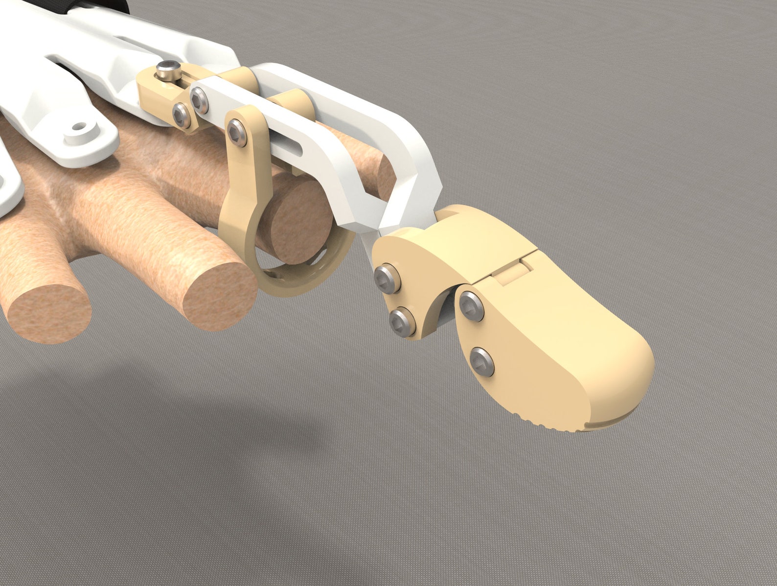 3D Print Prosthetic Finger STL Files: Full Hand Reconstruction (digital ...