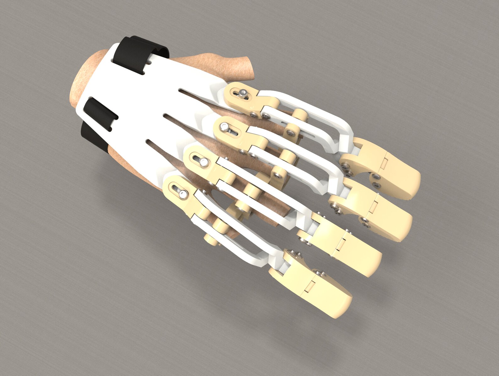3D Print Prosthetic Finger STL Files: Full Hand Reconstruction (digital ...