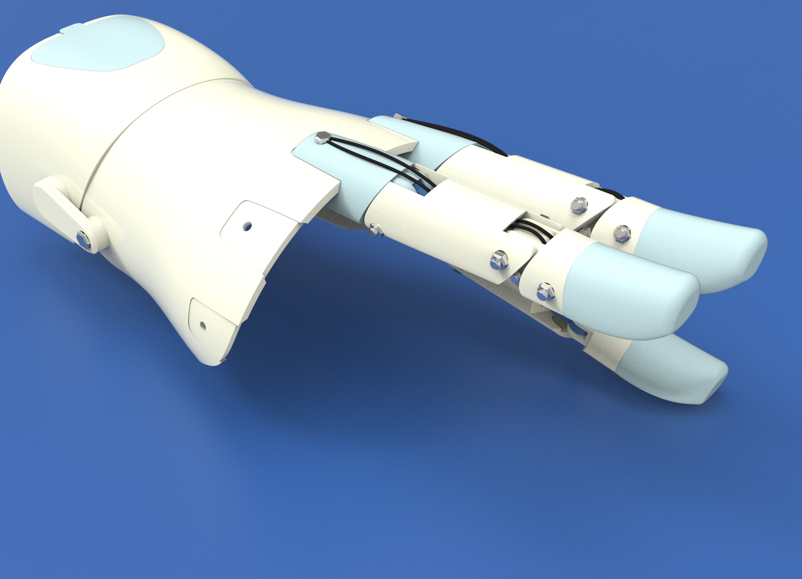 3D Printable Full Hand Prosthesis With Interchangeable Functional ...