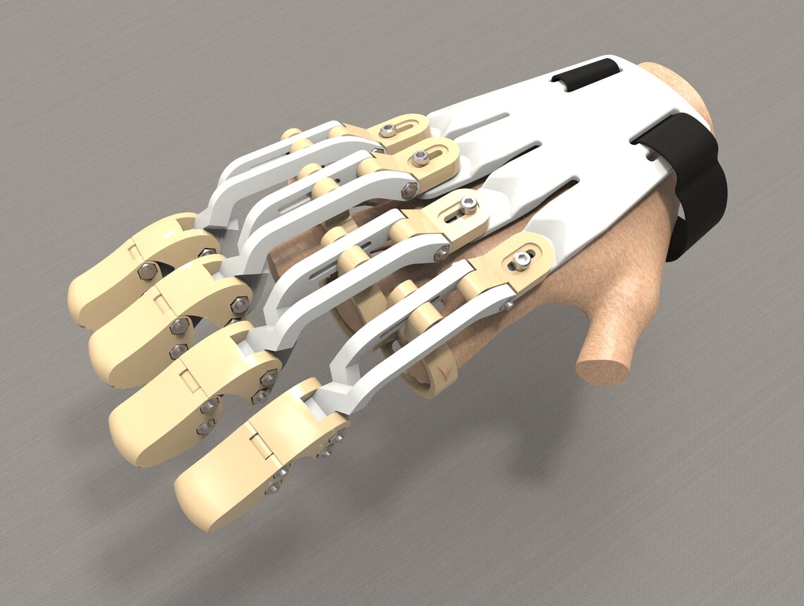 3D Print Prosthetic Finger STL Files: Full Hand Reconstruction (digital ...