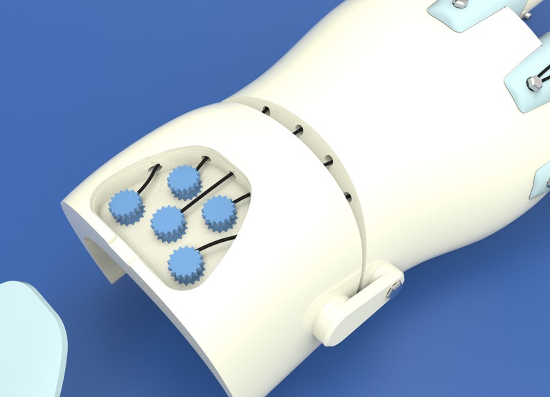 3D Printable Full Hand Prosthesis: Functional Fingertip Accessories ...