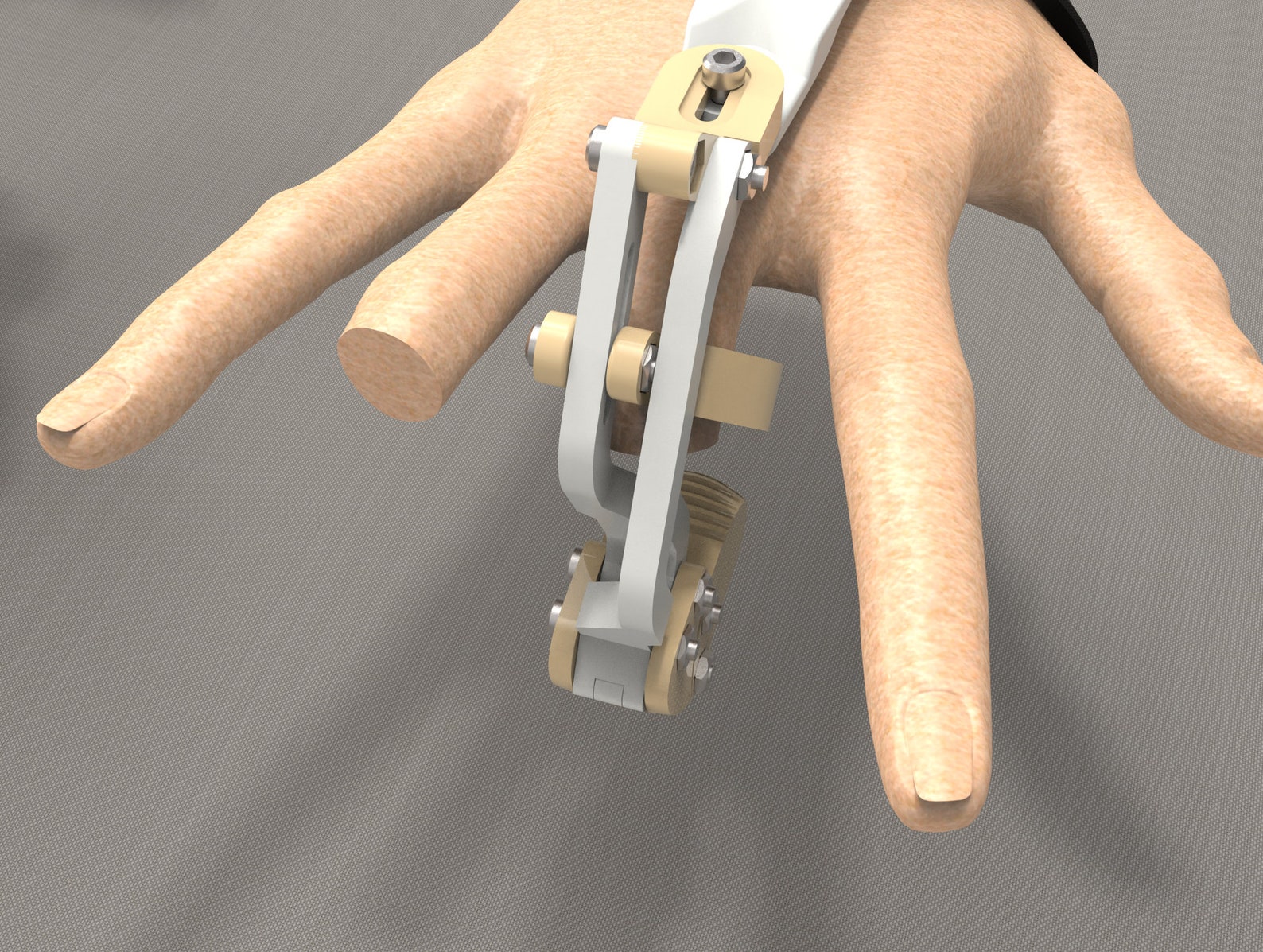 3D Print Prosthetic Finger STL Files: Full Hand Reconstruction (digital ...