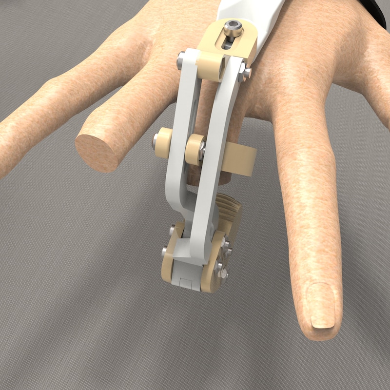 3d Printed Finger Prosthetic - Etsy