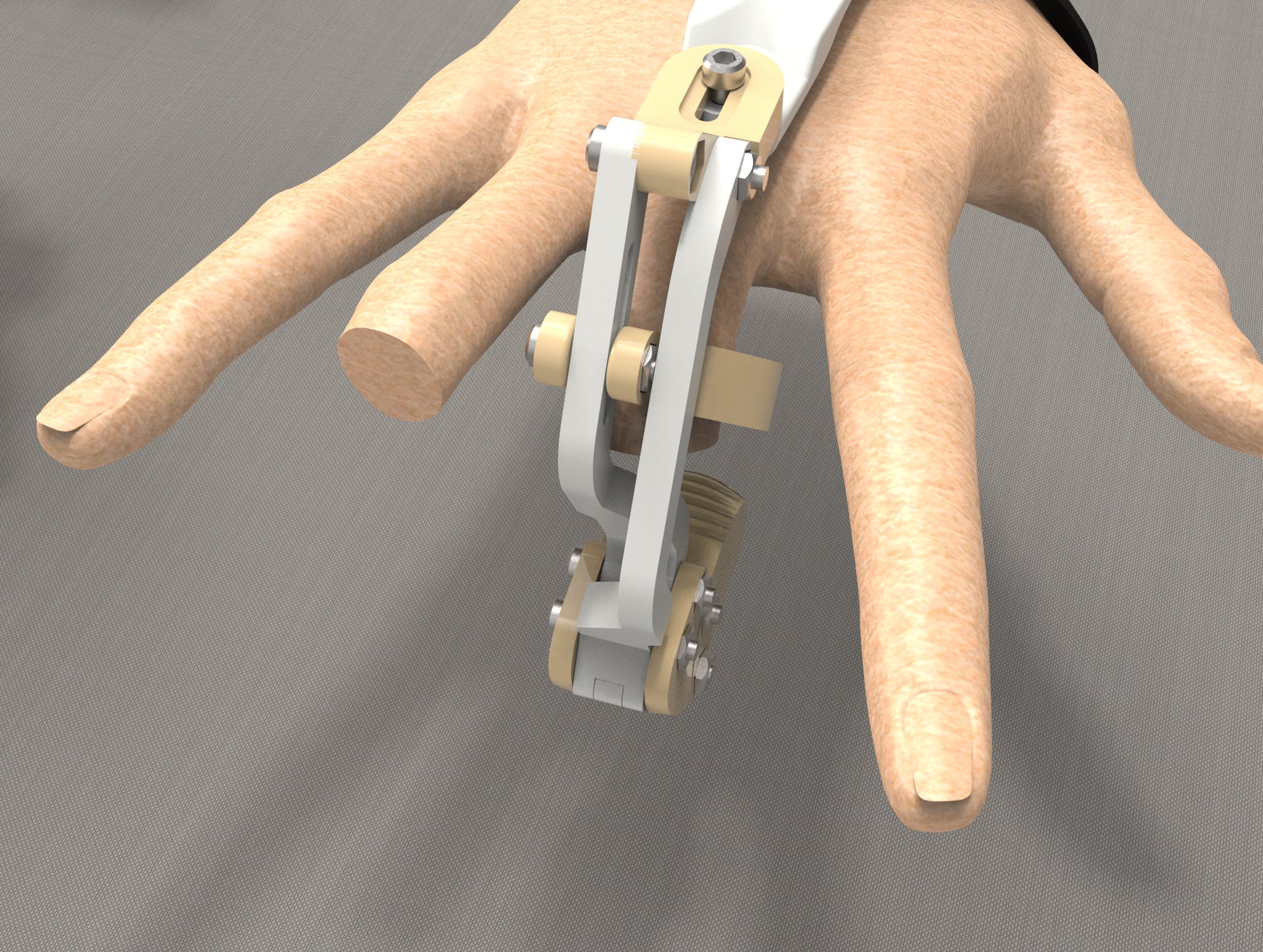 3D Print Prosthetic Finger STL Files: Full Hand Reconstruction (digital ...