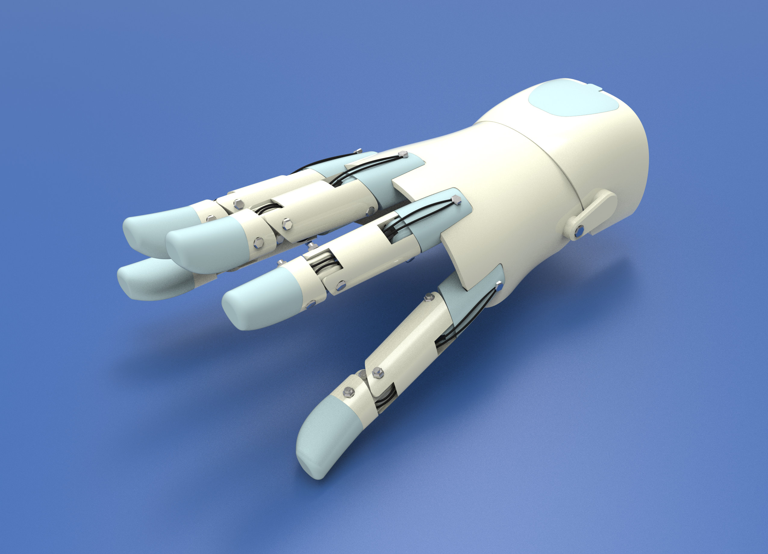 3D Printable Full Hand Prosthesis With Interchangeable Functional ...