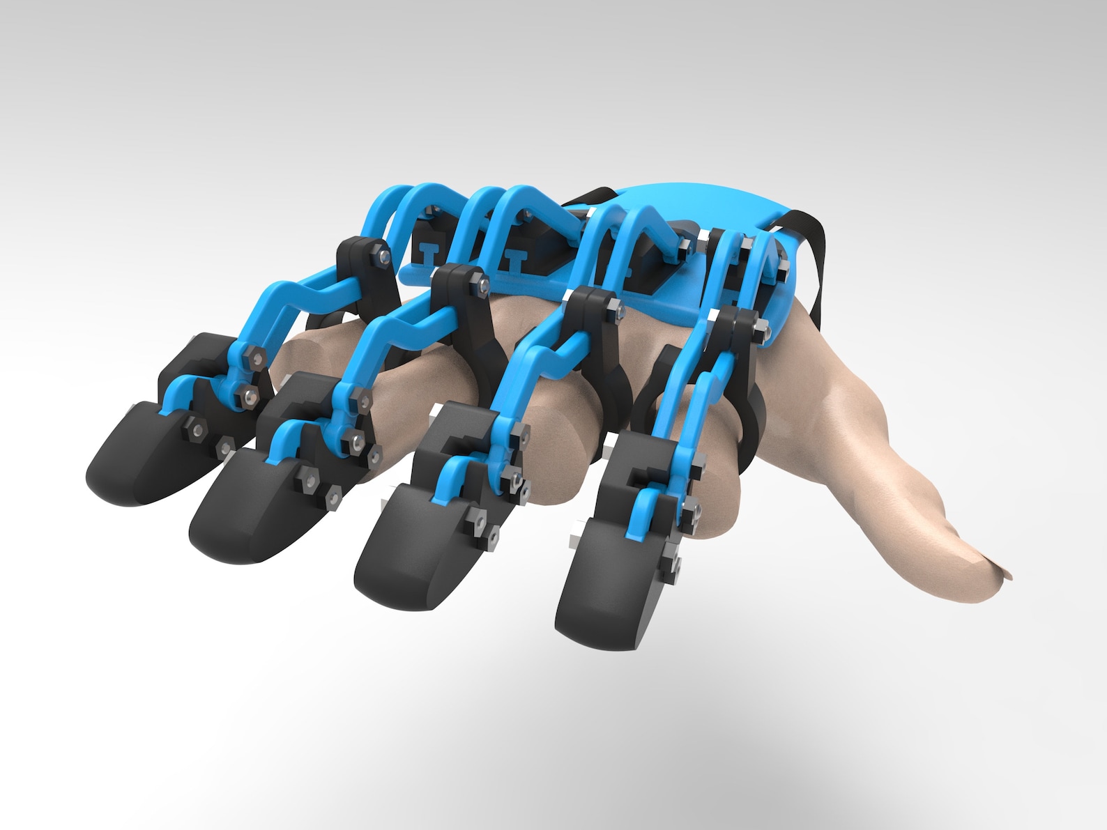 3D Print Prosthetic Finger STL File: DIY Hand Project (digital Download ...