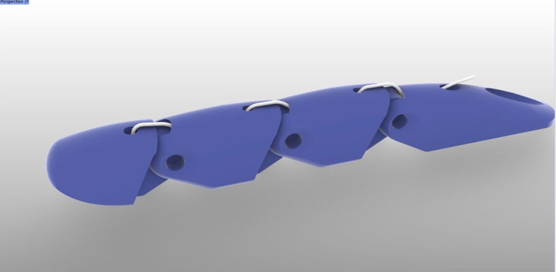 3D Print Prosthetic Hand With Elastics: STL Files (digital Download) - Etsy