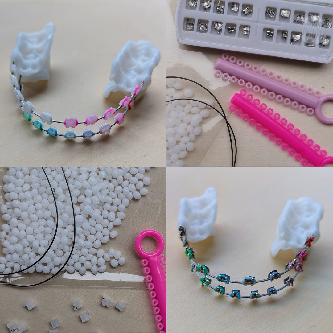 Metal & Ceramic Braces (combi Deal) - Cosplay DIY Kit - Etsy