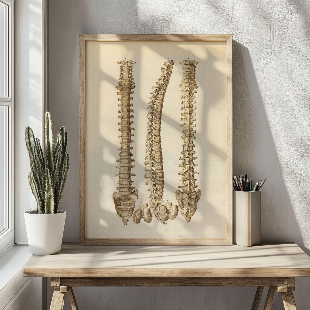 Anatomy Spine Art Print: Orthopedic Medical Poster - Etsy