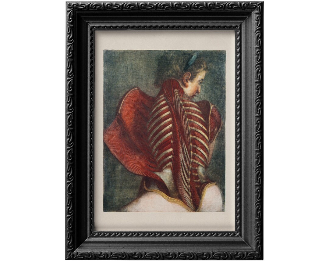 Anatomical Print of a Partial Dissection of a Woman,showing Bones and ...