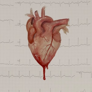 Bleeding Heart Anatomy Print, Anatomy Art, Watercolor Anatomical Heart ...
