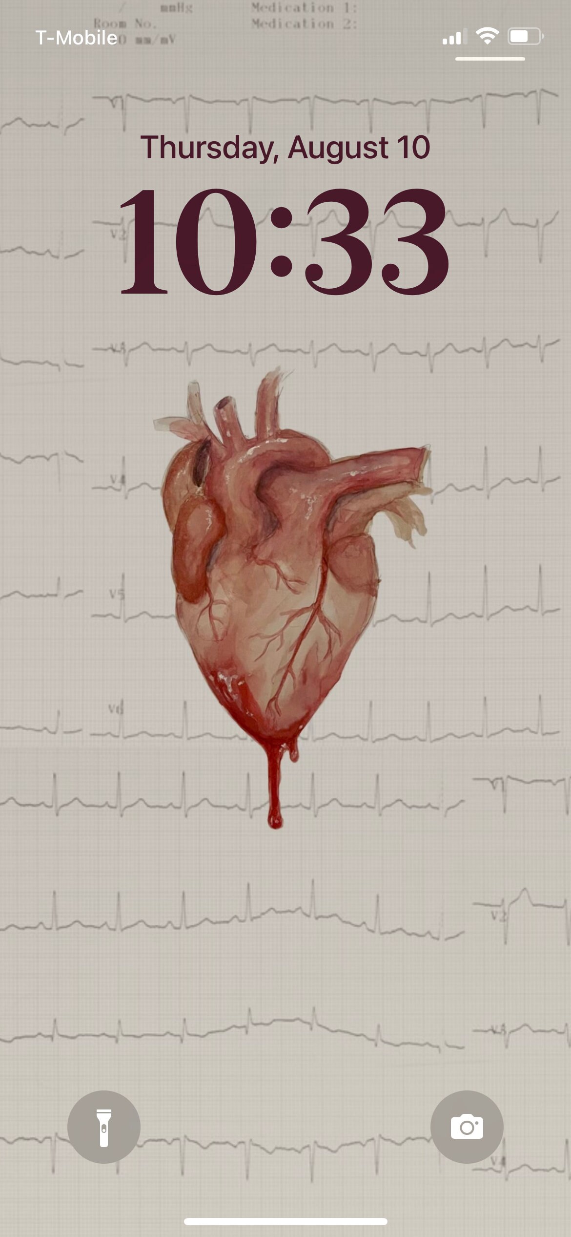 Bleeding Heart Anatomy Print, Anatomy Art, Watercolor Anatomical Heart ...