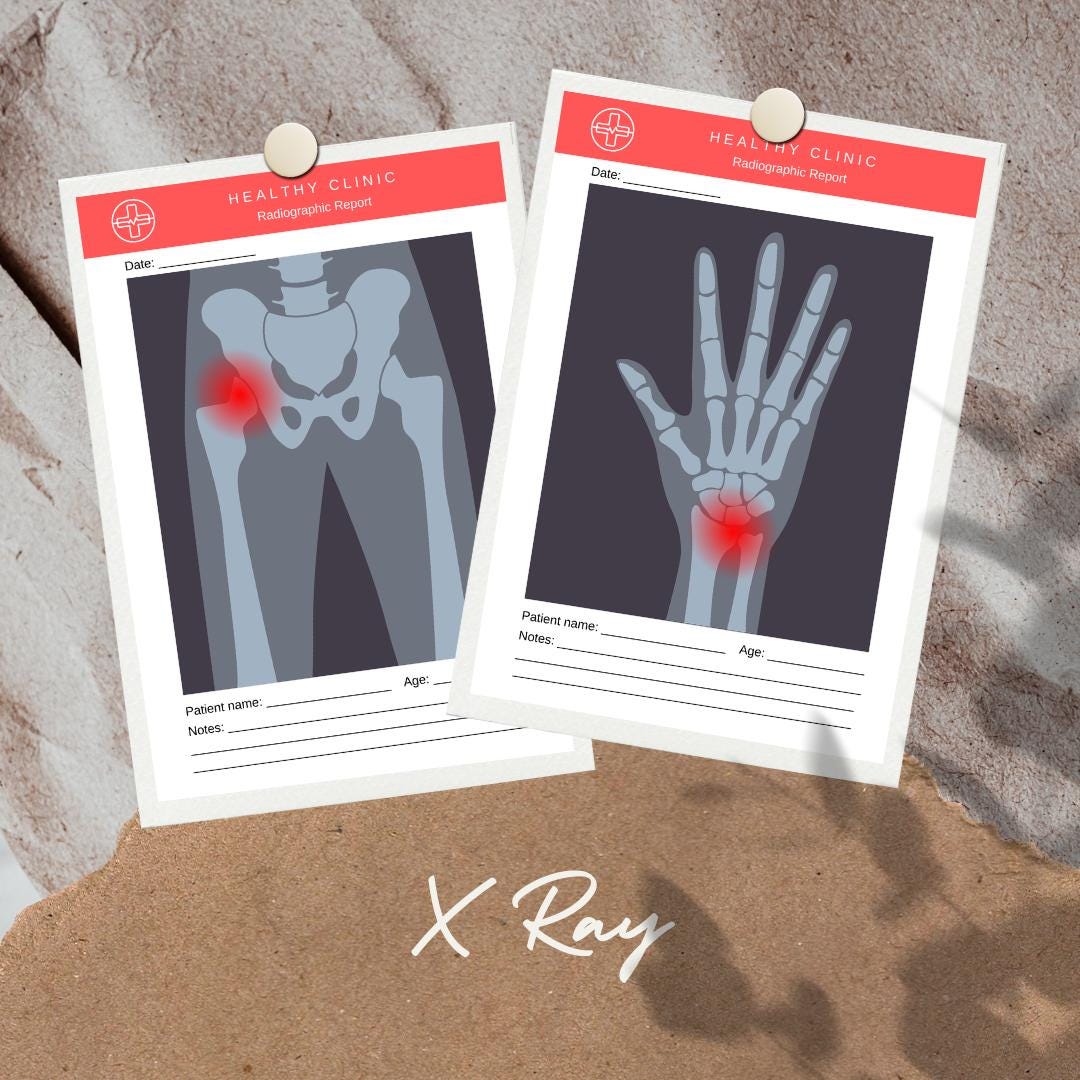 LITTLE DOCTOR: X-ray for Kids, Rontgen Rays, Doctor Pretend Play ...