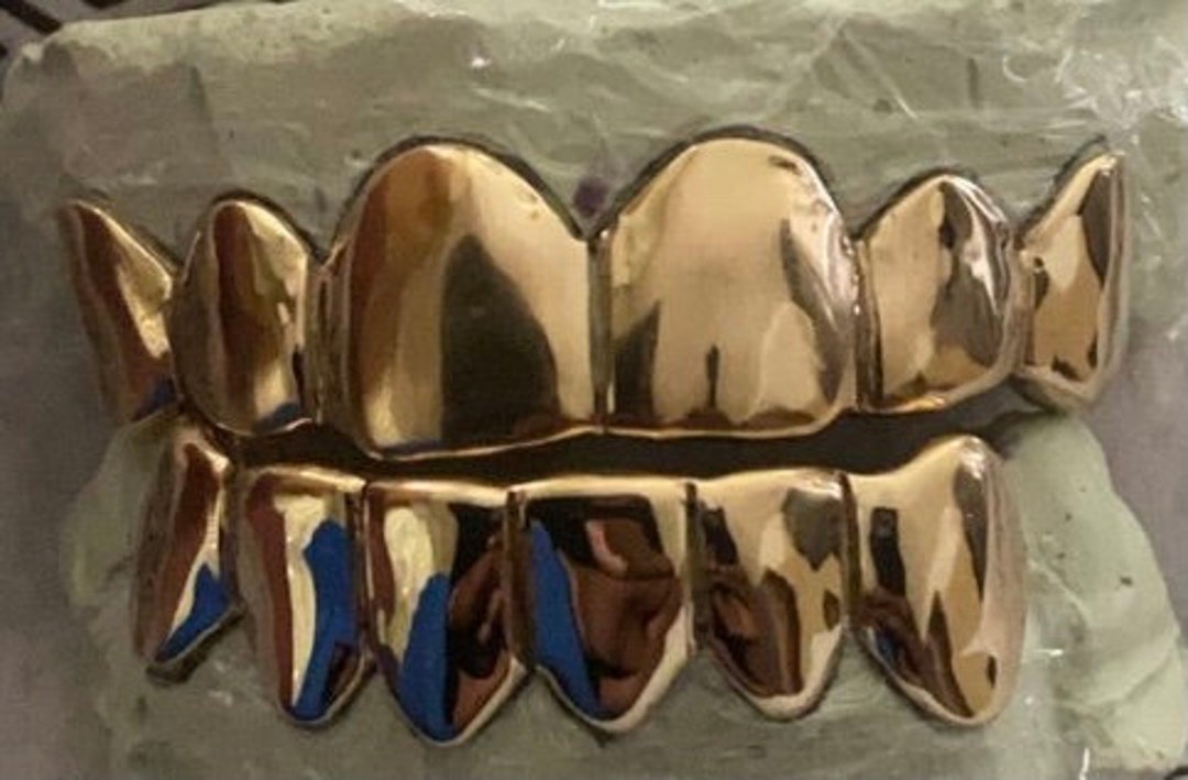 Silver 10k 14k 18k Gold Custom London Grillz - Etsy