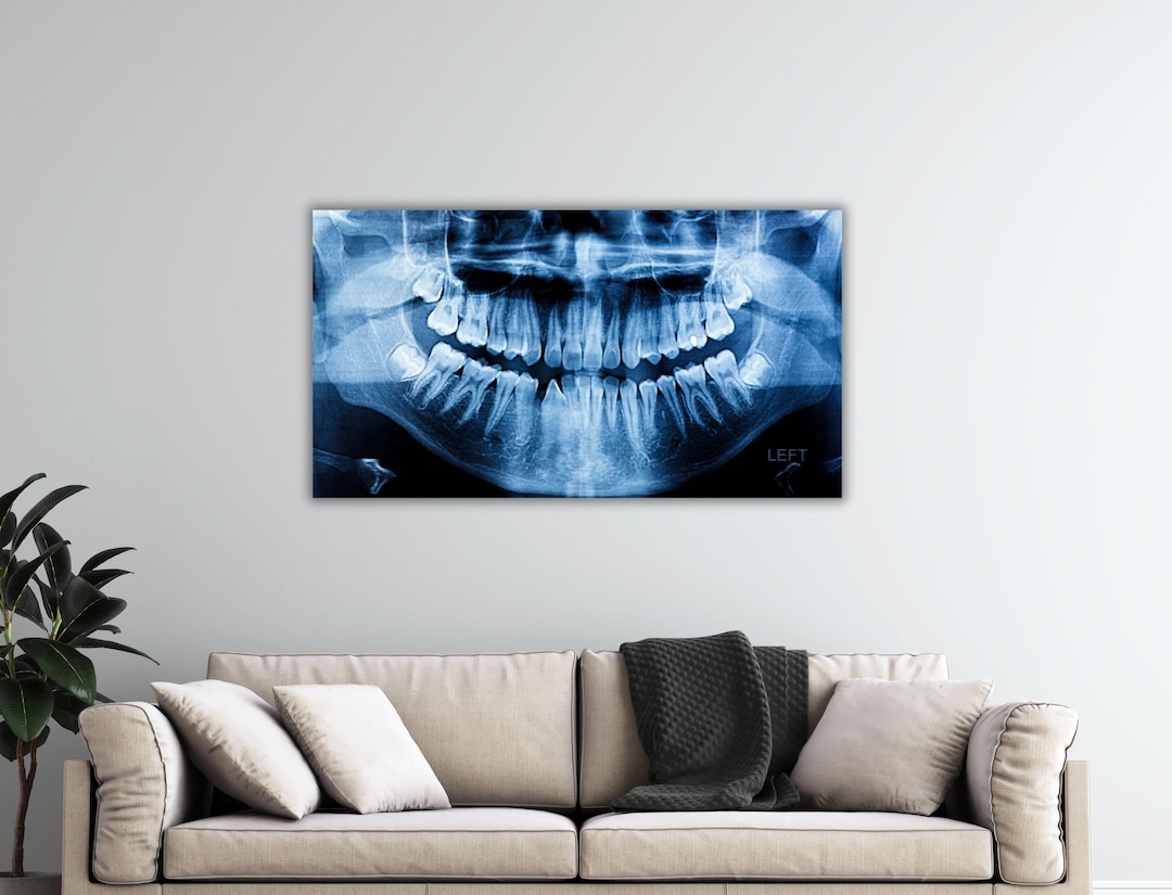 Teeth X-ray Wall Art Teeth X-ray Poster Dentis Room Wall Decor Art ...