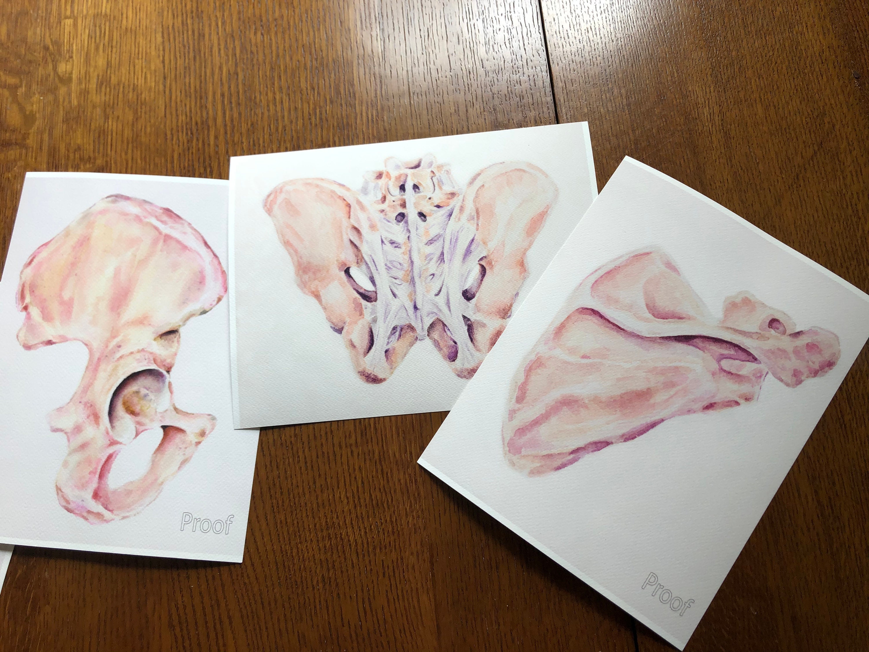 NEW Pelvis Hip Anatomy Illustration Lateral View Watercolor Giclée ...