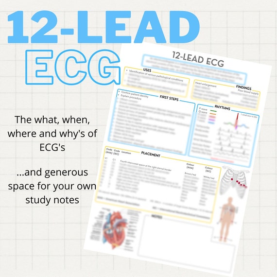 12 Lead ECG system guide for Nursing Students | Etsy