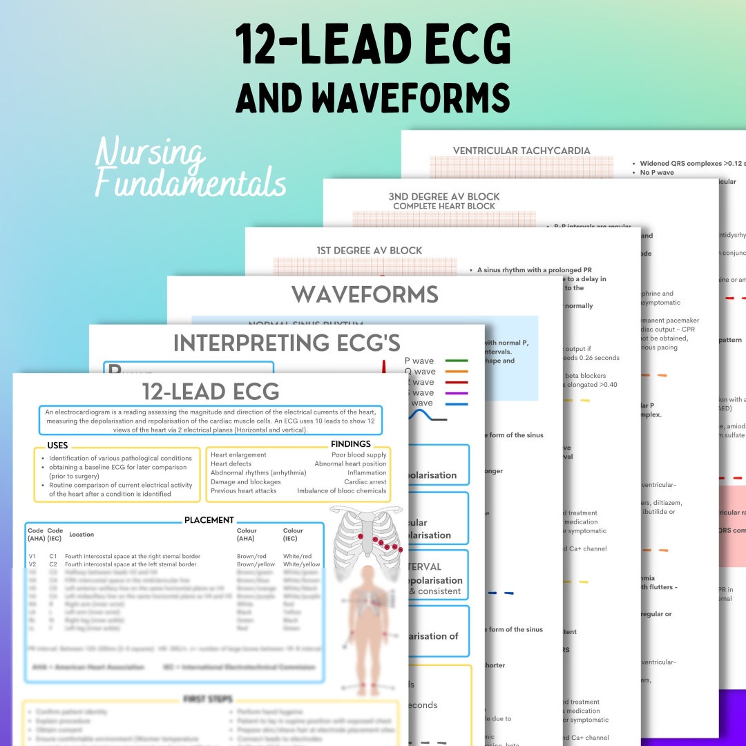 12 Lead ECG System and Waveforms Guide for Nursing Students - Etsy