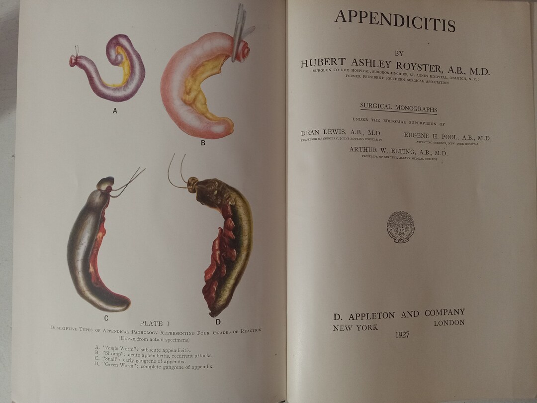 Surgical Monographs "appendicitis", Published in 1927, by Hubert Ashley ...