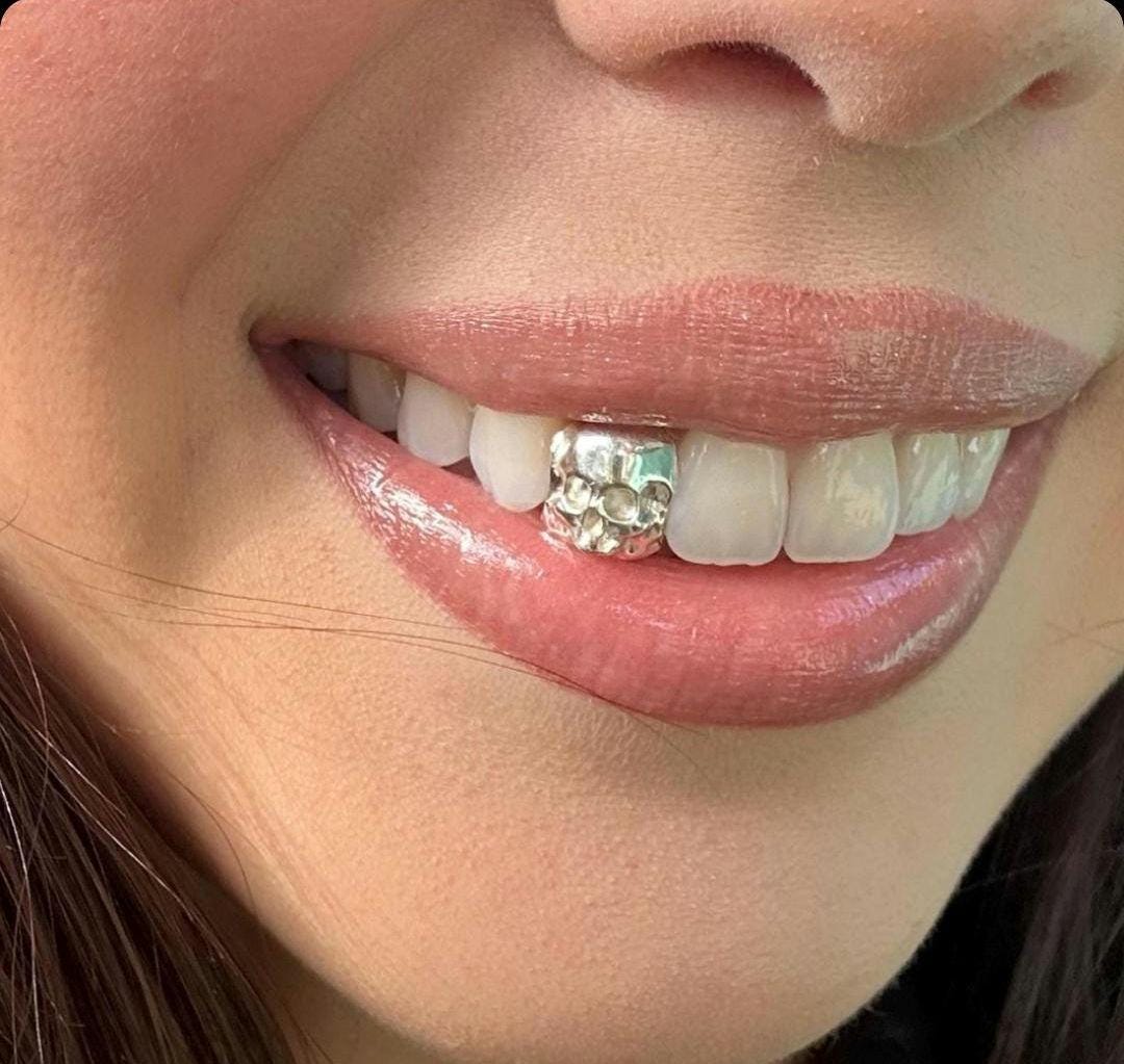CUSTOM GRILLZ - Gold Silver Dental Caps Custom Made - Etsy