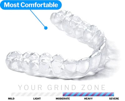 Custom Night Grind Guard for Snoring Dental Grade Impression - Sleep ...