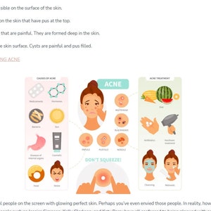 Natural Acne Remedies You Can Make at Home. Improve Your Skin With ...