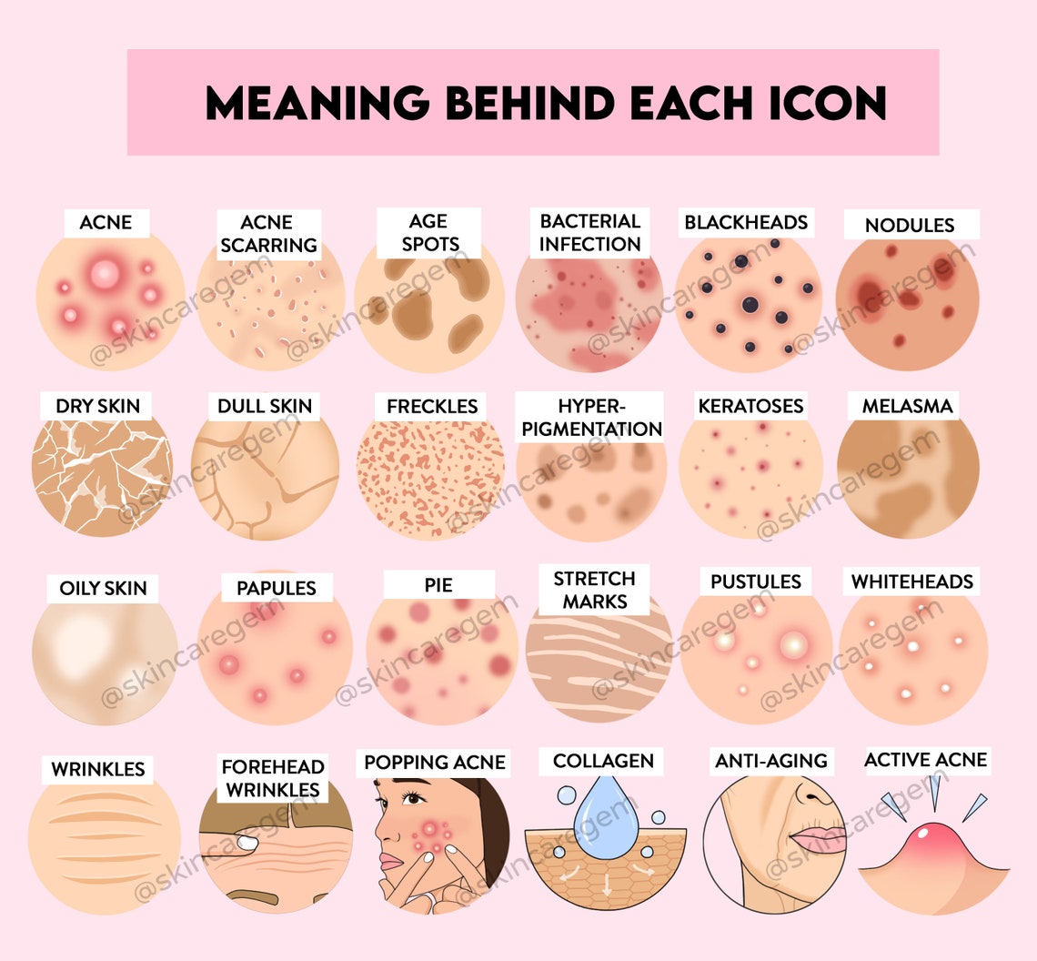 24 SKIN ICONS (instant Download) - Etsy