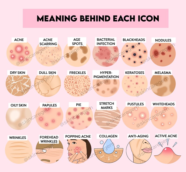 24 SKIN ICONS (instant Download) - Etsy