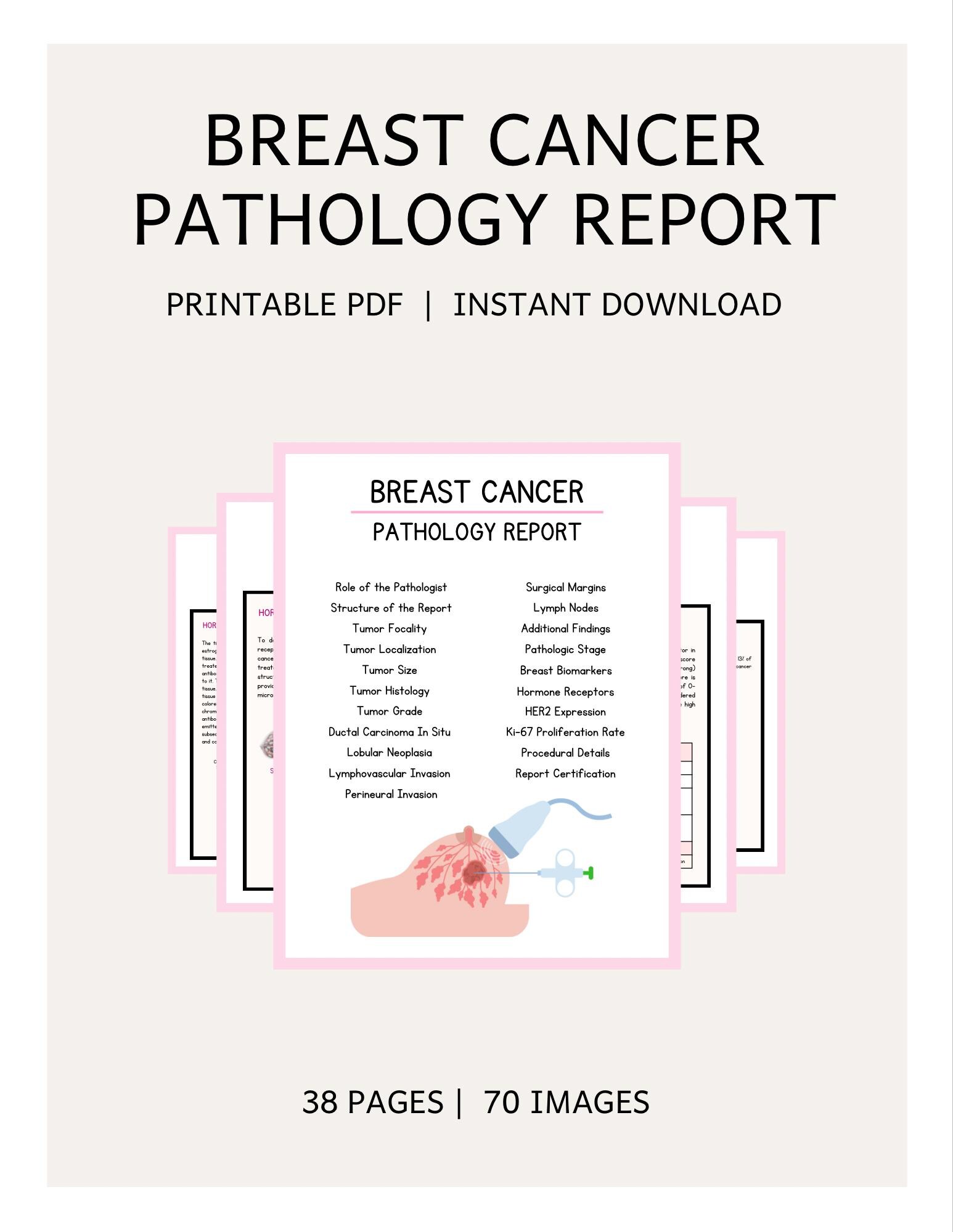 Understanding the Breast Cancer Pathology Report Informational Guide - Etsy